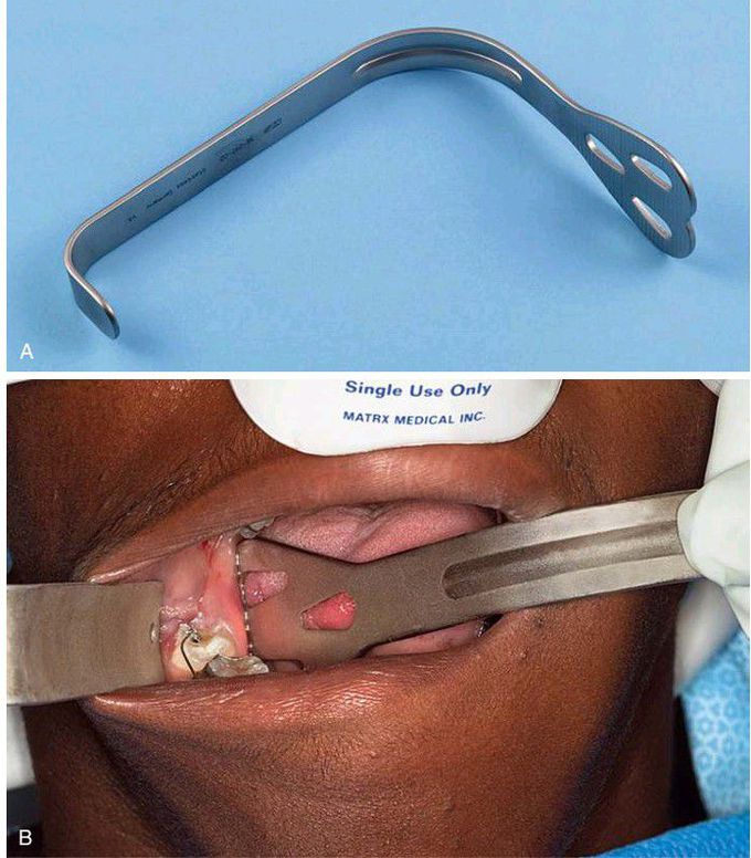 Weider retractor - MEDizzy