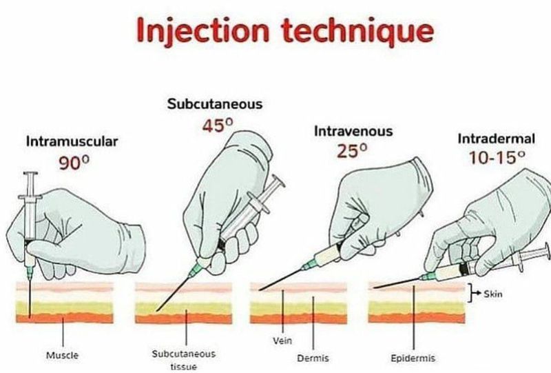 Injection techniques.... - MEDizzy