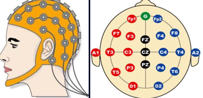 EEG electrodes! - MEDizzy