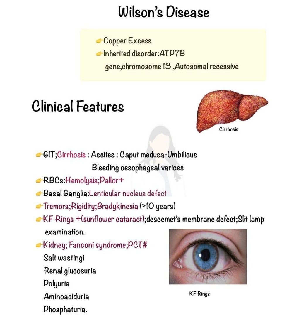 Wilson's Disease - MEDizzy