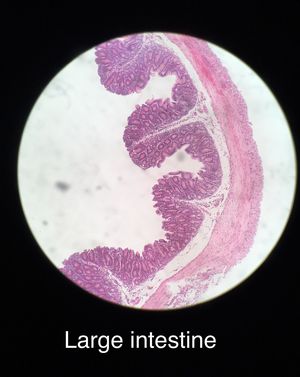 Large Intestine - MEDizzy