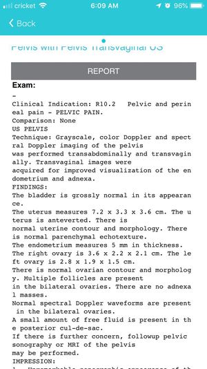 This is my Ultrasound - MEDizzy