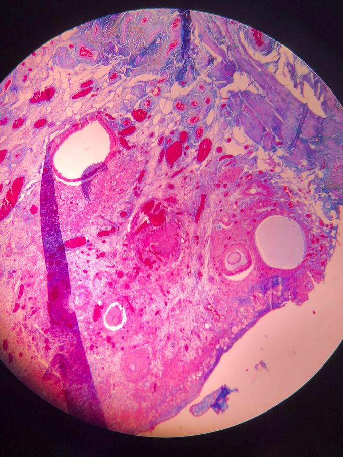 What is it? - MEDizzy