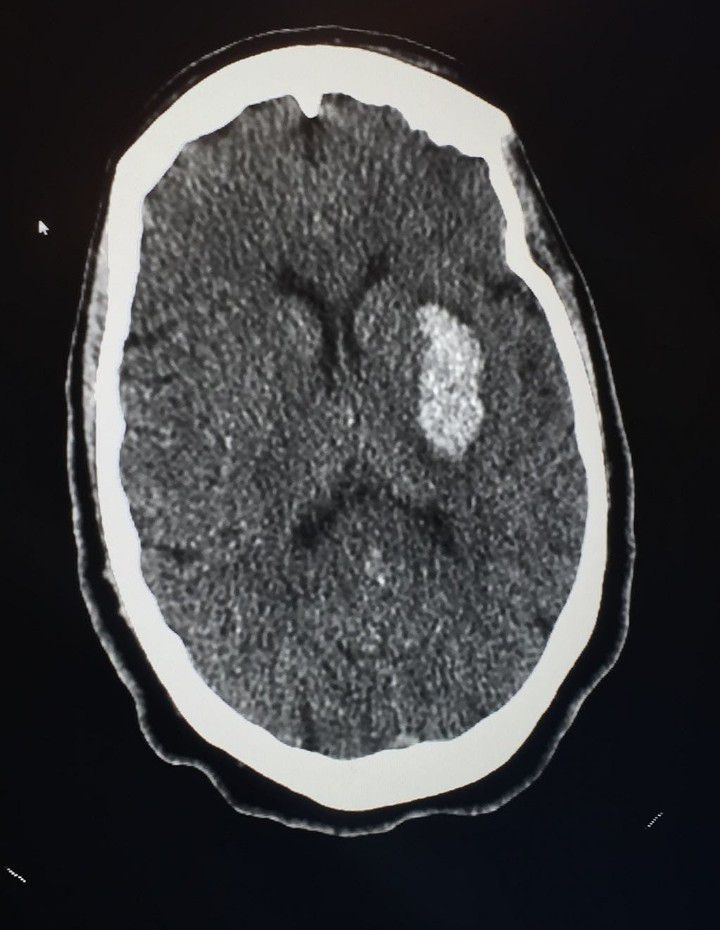 Neurosurgery - MEDizzy