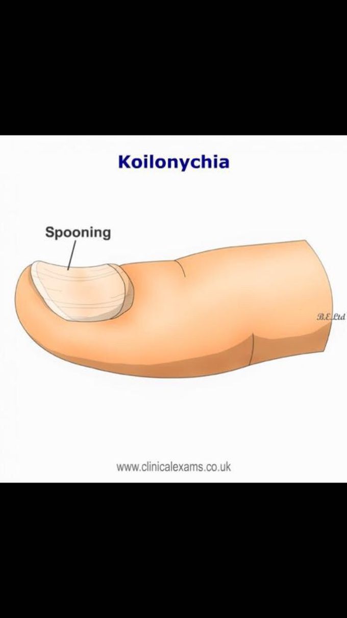 Spooning Diagram