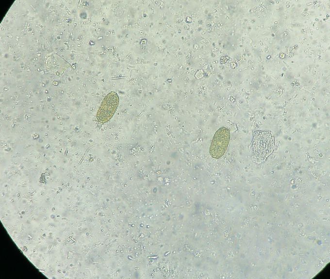 Stool Examination - MEDizzy