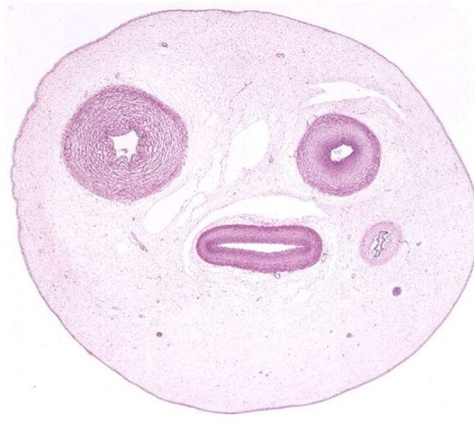 Umbilical cord - MEDizzy