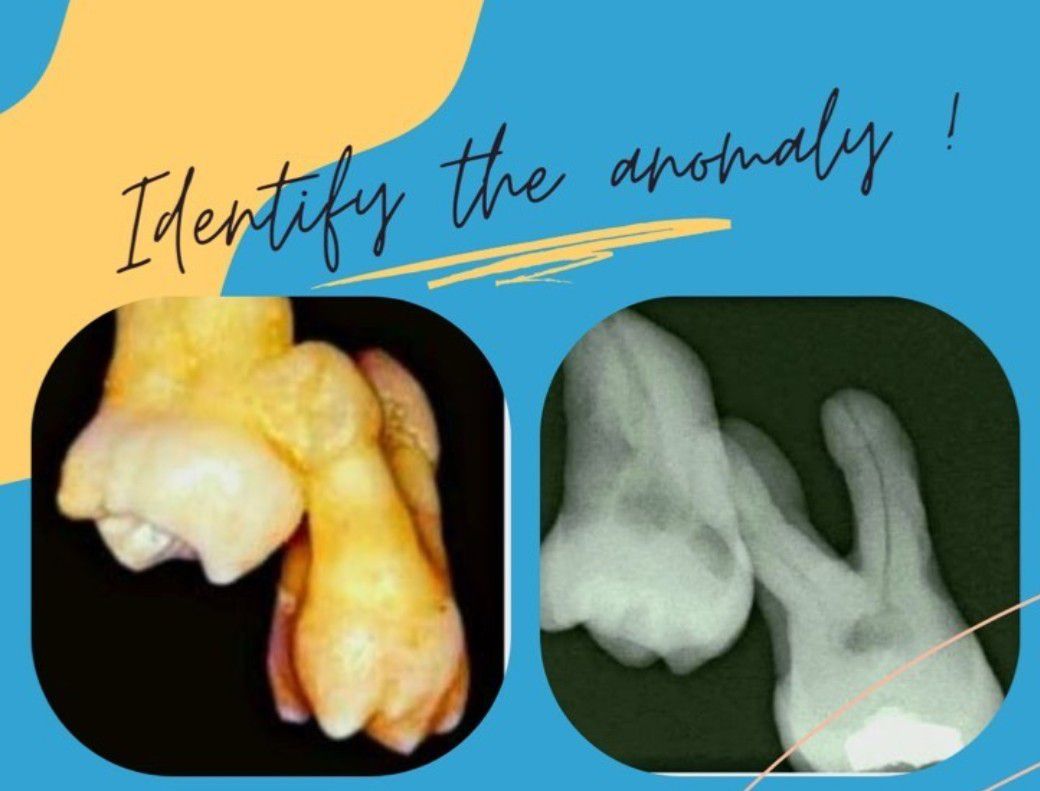 Identify the Anomaly -I - MEDizzy