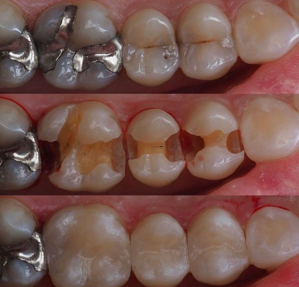 A Dreaded Dental Treatment - MEDizzy