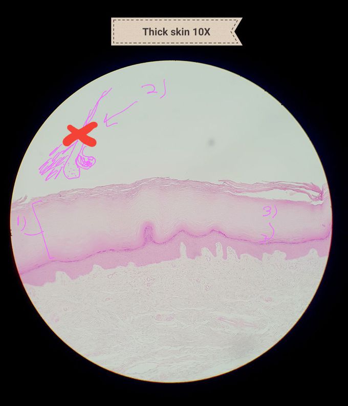 Identification of Thick skin - MEDizzy