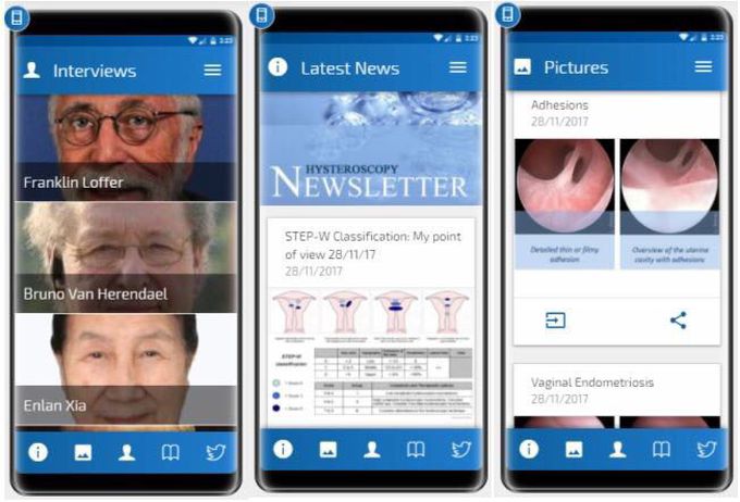 Hysteroscopy.info - MEDizzy