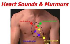 Heart sounds & Murmurs - MEDizzy