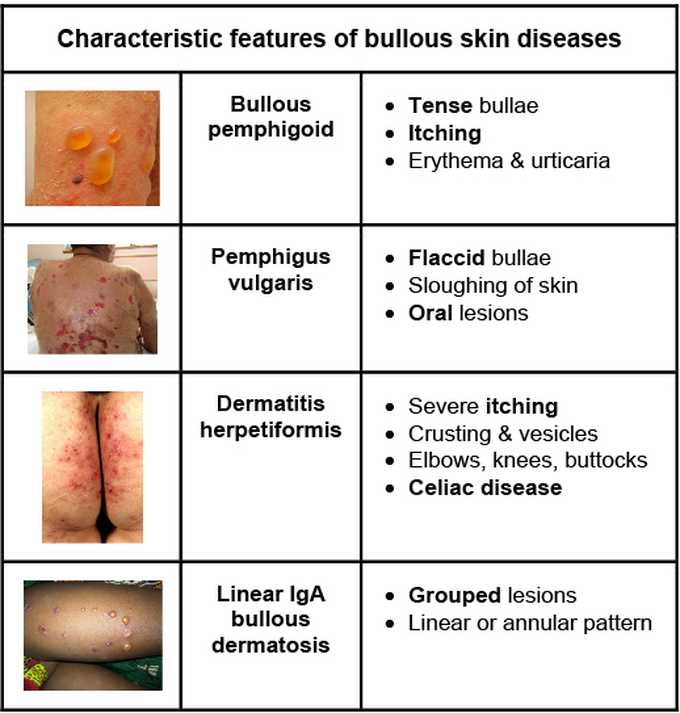 Bullous Skin Disease MEDizzy