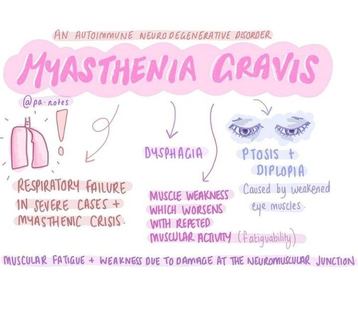 Myasthenia Gravis - MEDizzy