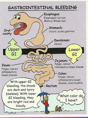 Bleeding from GIT - MEDizzy