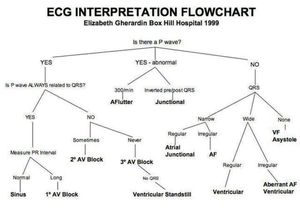ECG Interpretation Flowchart - MEDizzy