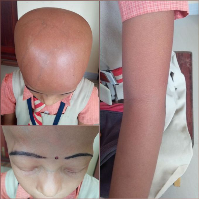 Diagnosis ? Rare case - MEDizzy