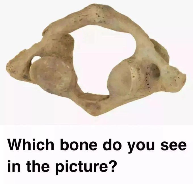 Identify the Bone - MEDizzy