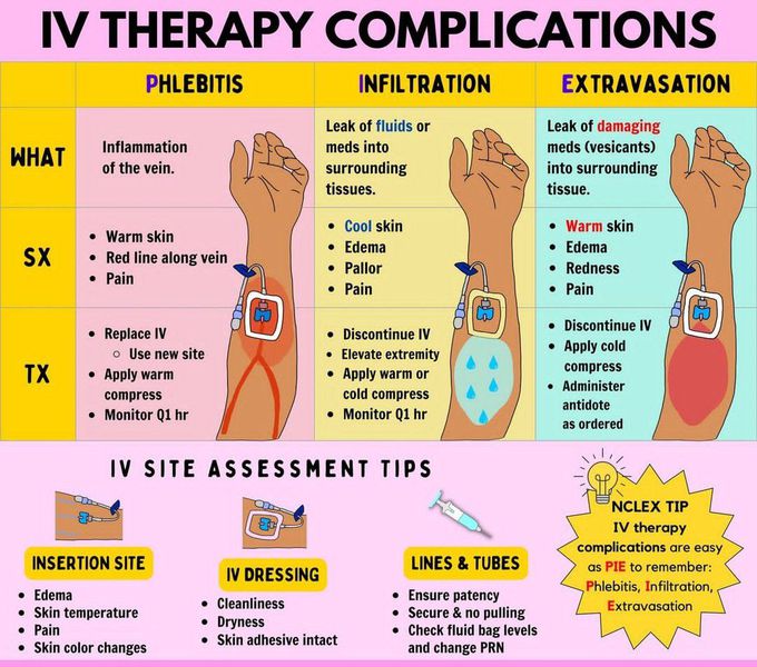 Complications Of IV Therapy MEDizzy