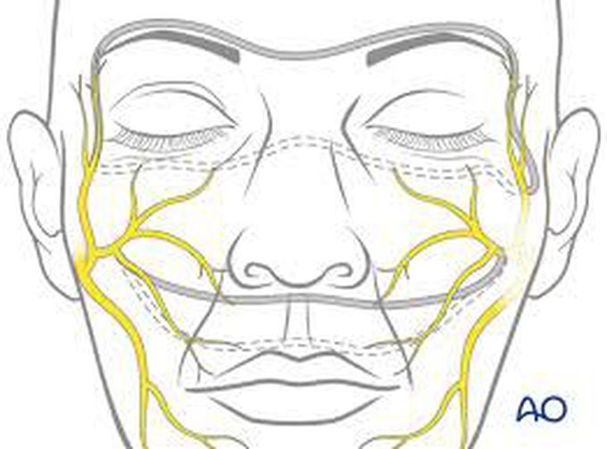 Cross facial nerve graft - MEDizzy