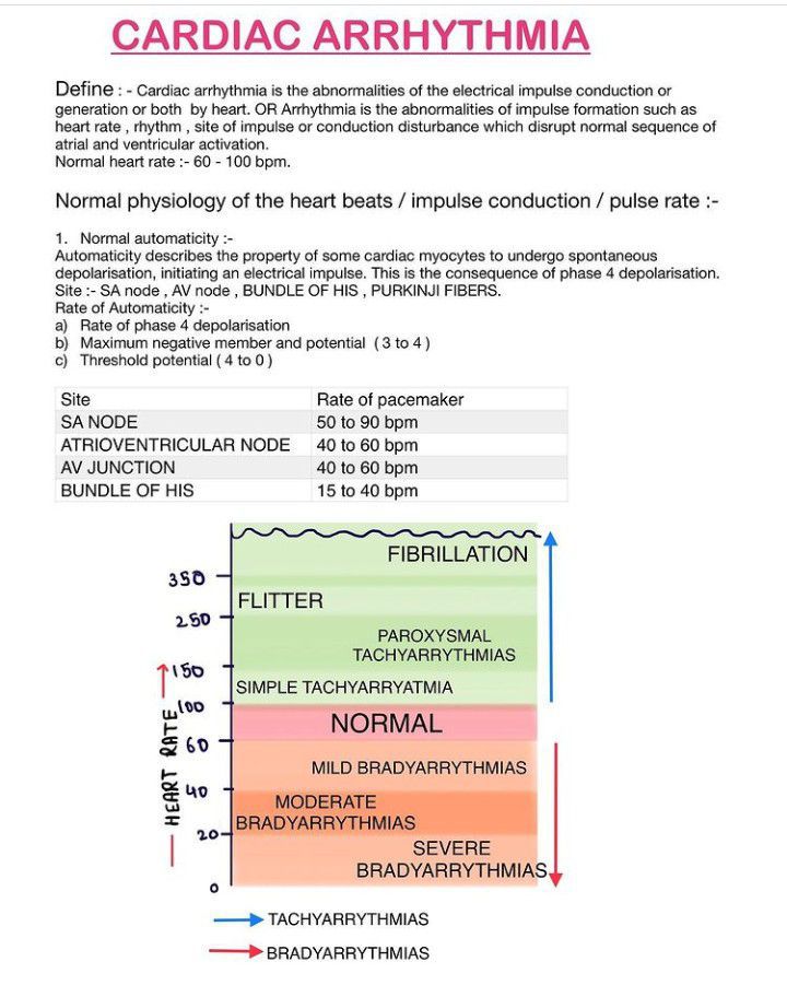 Cardiac Arrhythmia-Review - MEDizzy