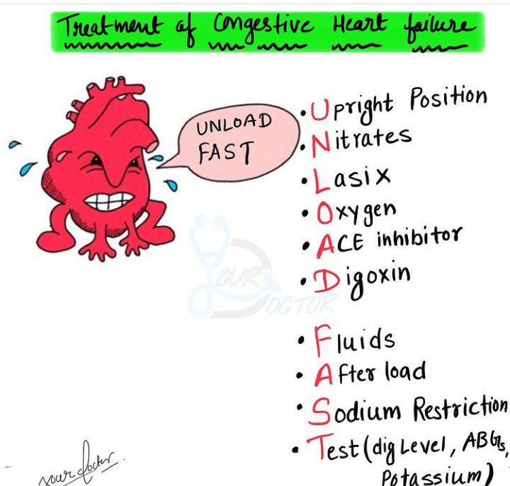Mnemonic Treating Congestive Heart Failure Chf Unload ABC Cardiol