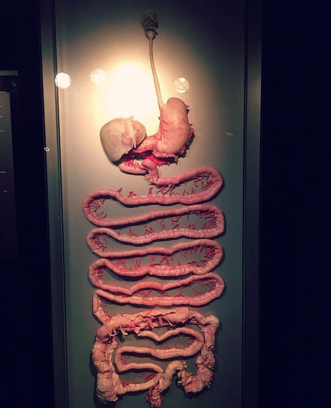 Human gastrointestinal tract without a human - MEDizzy
