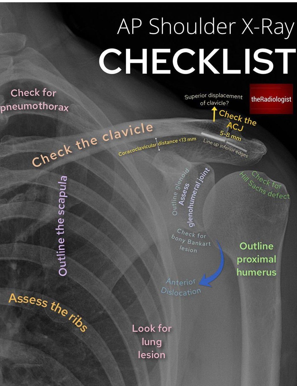 AP Shoulder X ray MEDizzy