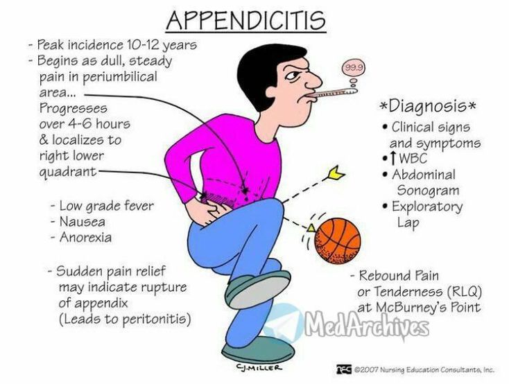 Appendicitis - MEDizzy