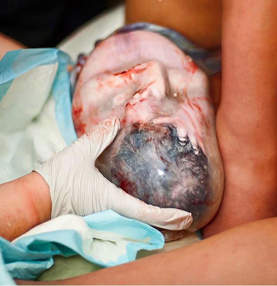 Baby Born In The Caul