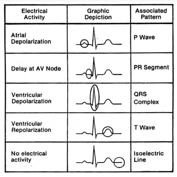 Electrocardiogram changes - MEDizzy