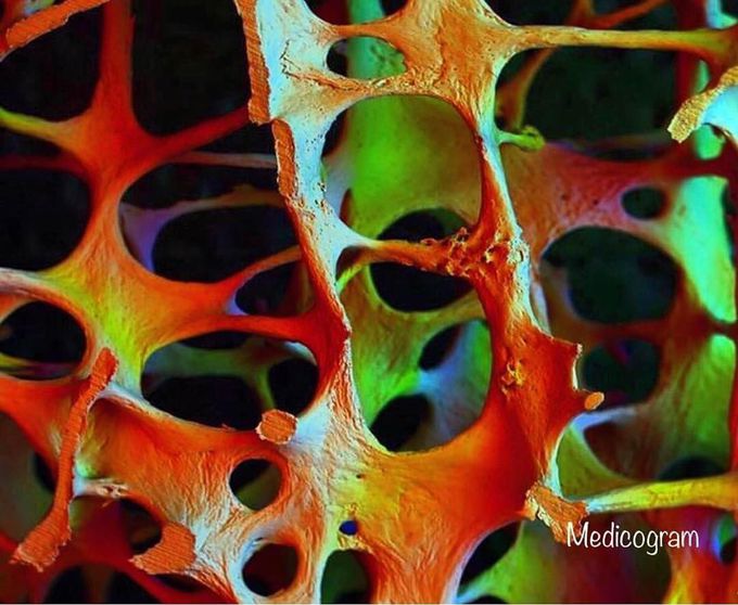 Bone architecture - MEDizzy