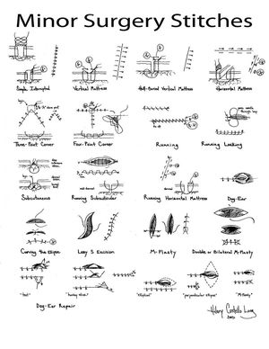 Suturing types - MEDizzy