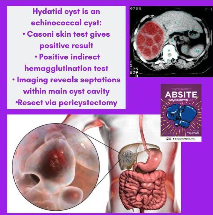 General surgery - MEDizzy
