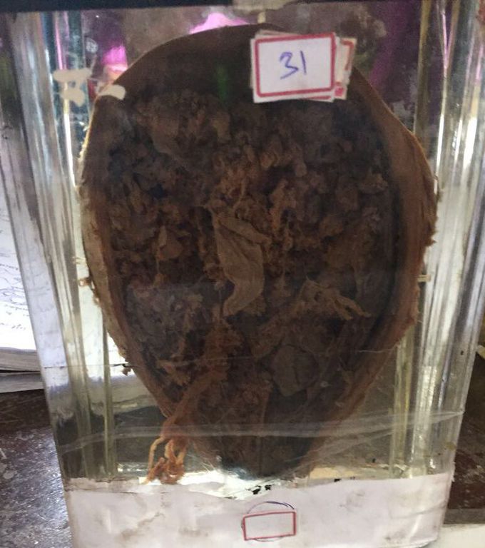 Pathology Gross specimen - MEDizzy