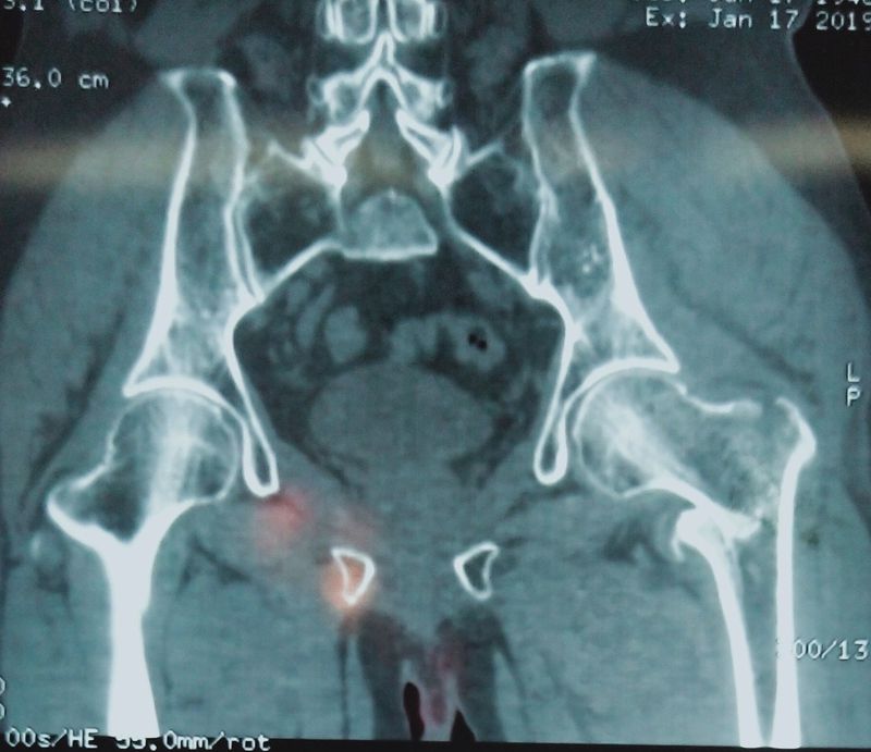 Orthopedics case. - MEDizzy