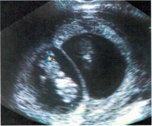 What u can see in this USG??? - MEDizzy