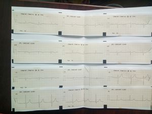 Electrocardiograph - MEDizzy