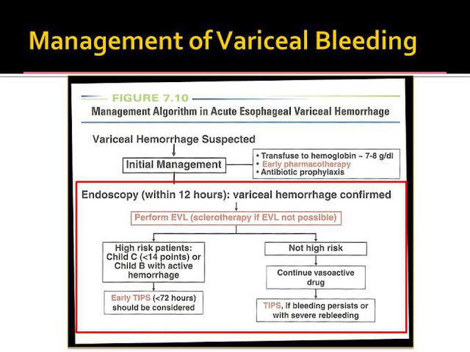 Management of variceal bleeding - MEDizzy