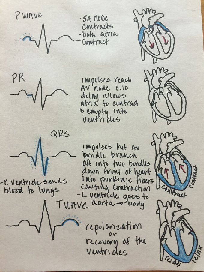 Ecg simplified - MEDizzy
