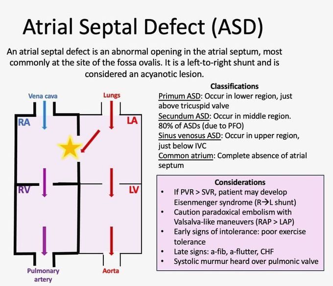 Atrial Septal Defect - MEDizzy