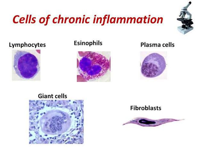 Cells of chronic inflammation - MEDizzy