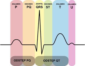 An intuitive ECG diagram - MEDizzy
