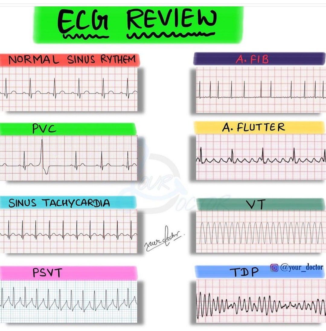ECG Review - MEDizzy
