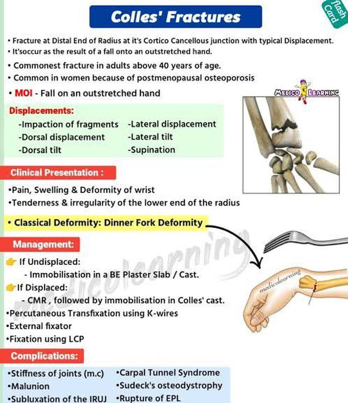 Colles Fracture Review MEDizzy