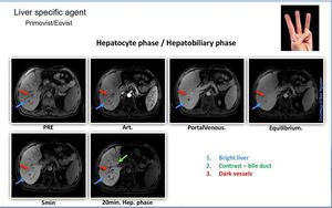 3 Finger Rule regarding hepatocyte/hepatobiliary phase - MEDizzy