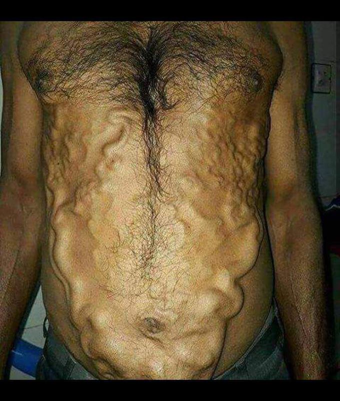 Post number 1099017 - MEDizzy