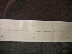 What's problem - MEDizzy