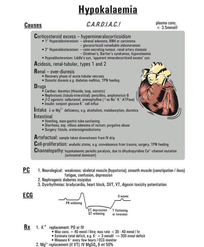 Hypokalemia - MEDizzy