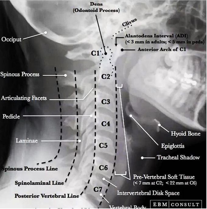 X ray view - MEDizzy